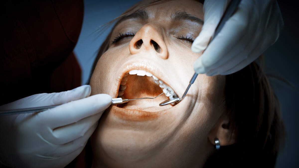 Dental amalgam banned from January | Luxembourg Times